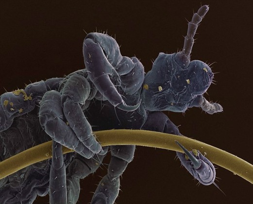 10 Things That Look Absolutely Bizarre Under a Microscope - Mind ...