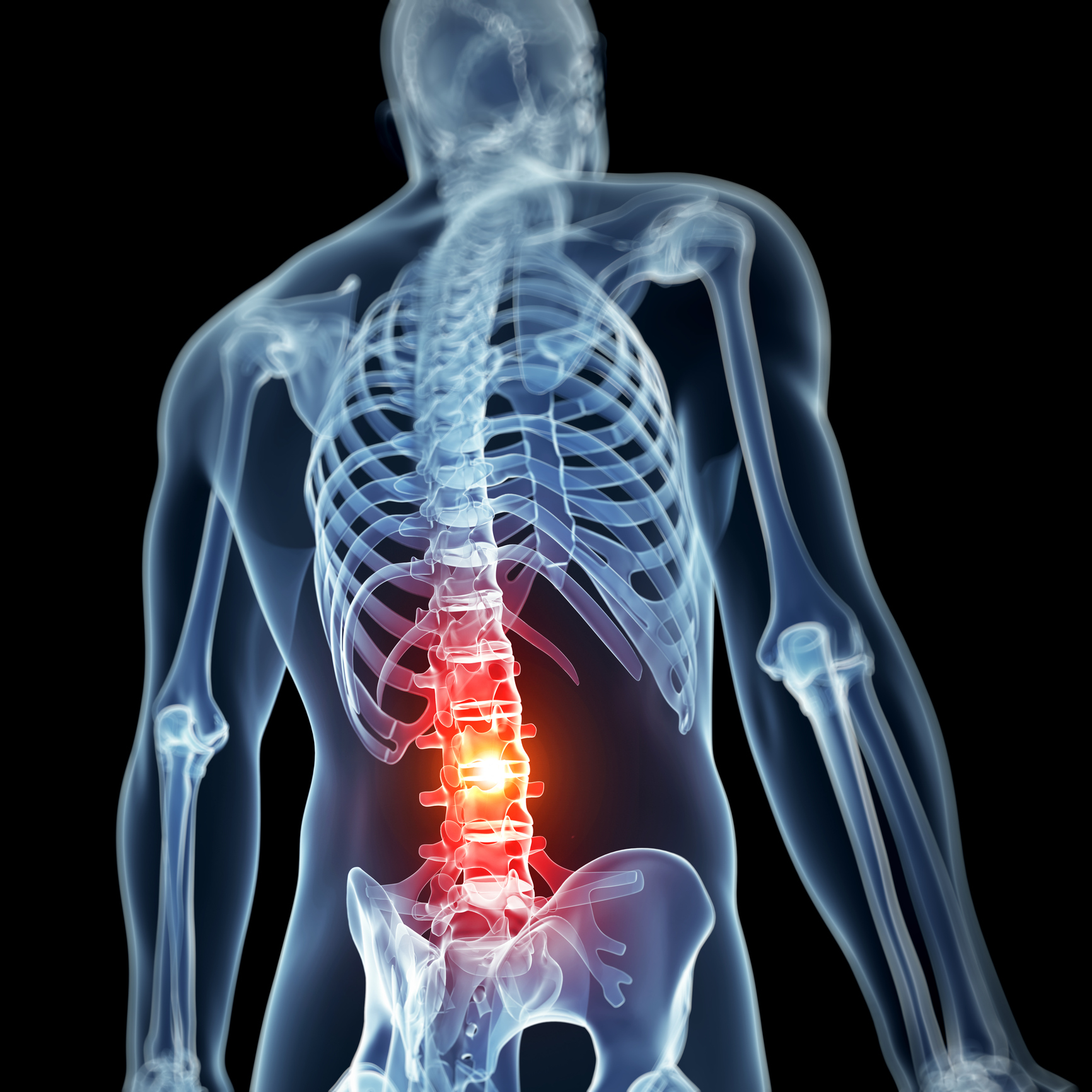 Upper Back Pain : Identifying and Dealing with All the Causes – Topcount